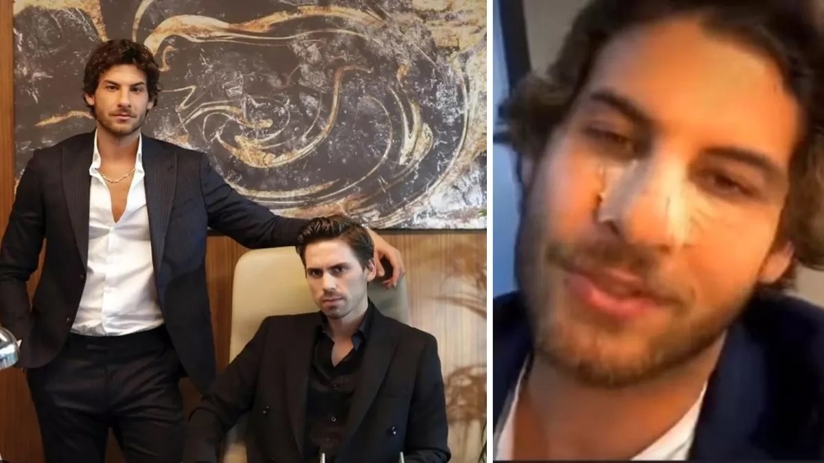 Dövüş Sahnesi Gerçeğe Dönüştü, Ünlü Oyuncunun Burnu Kırıldı!